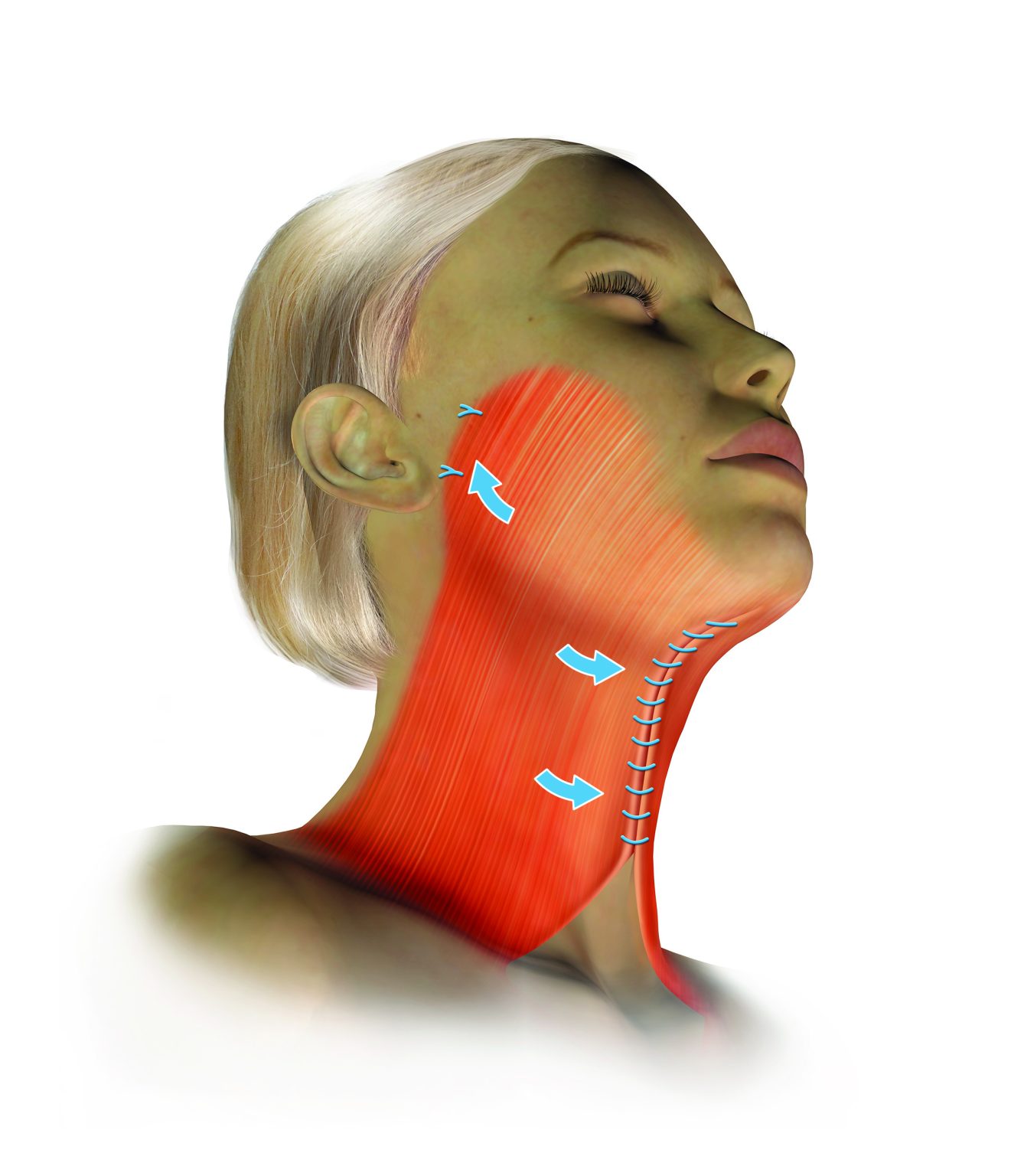 Deep Plane Facelift Surgeon Sydney | Dr Jason Roth FRACS