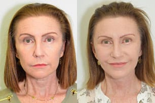 Dr Jason Roth | ENT Specialist | Northern Beaches