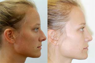 Dr Jason Roth | ENT Specialist | Northern Beaches